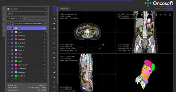 Qt 그룹, 온코소프트의 AI 의료영상 분석 소프트웨어 ‘OncoStudio 2.0’에 개발 플랫폼 지원 - 한국인포맥스